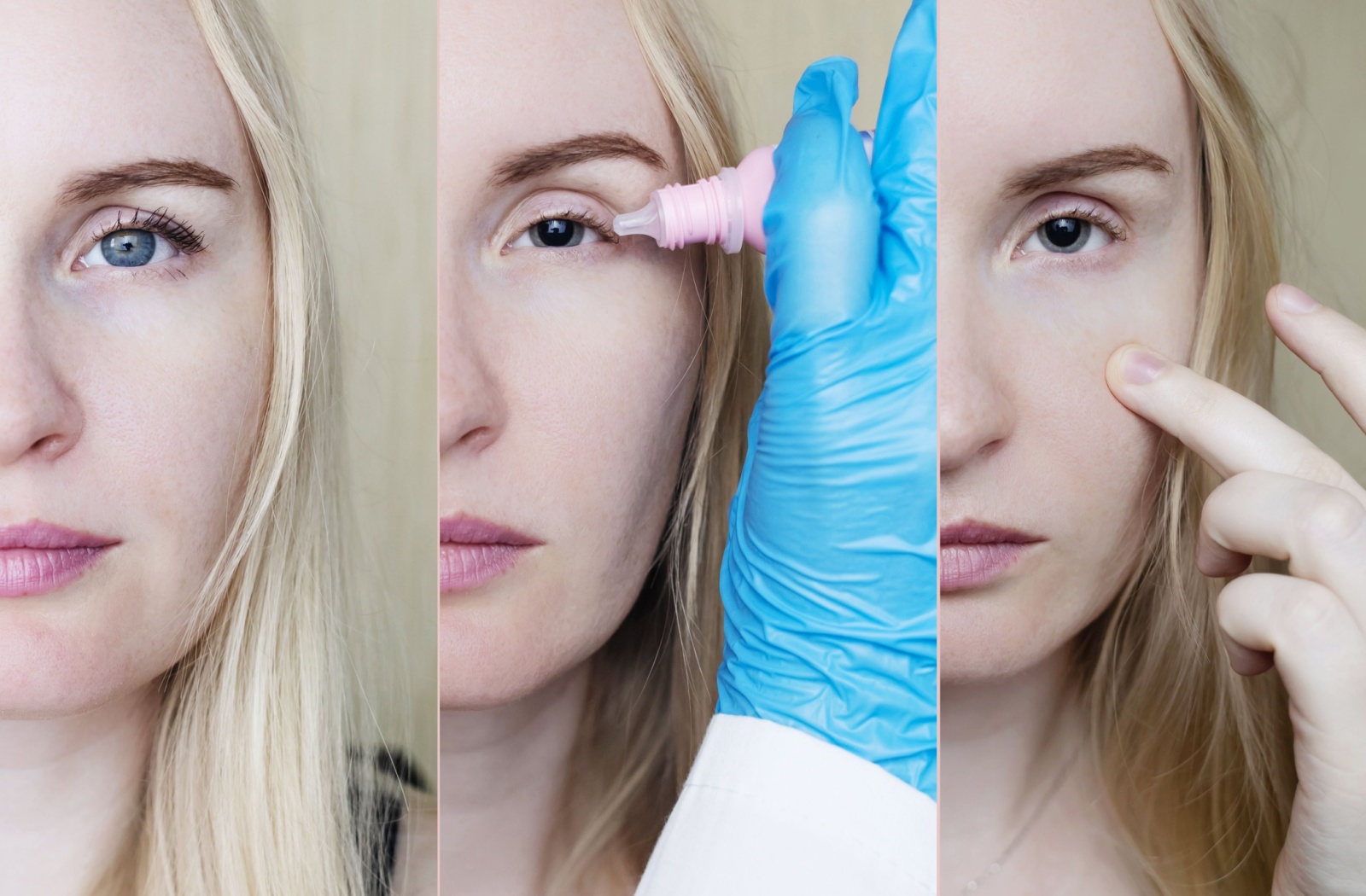 Why Do Optometrists Dilate Your Eyes? - Total Vision Hercules